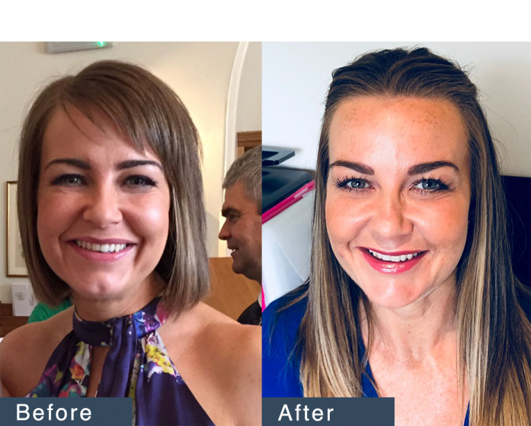 Facial profiling treatment at Sapphire Aesthetics in Hereford